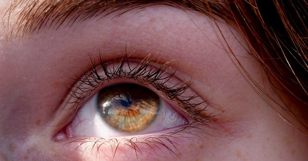 Astigmatism vs Lazy Eye: Understanding the Difference